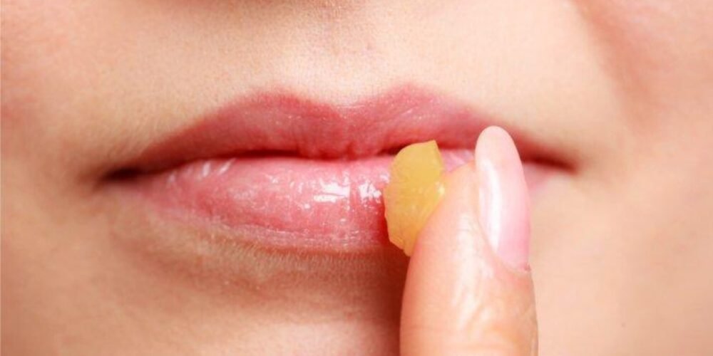 Dry & Peeling Lips? Discover Why and How to Treat Them